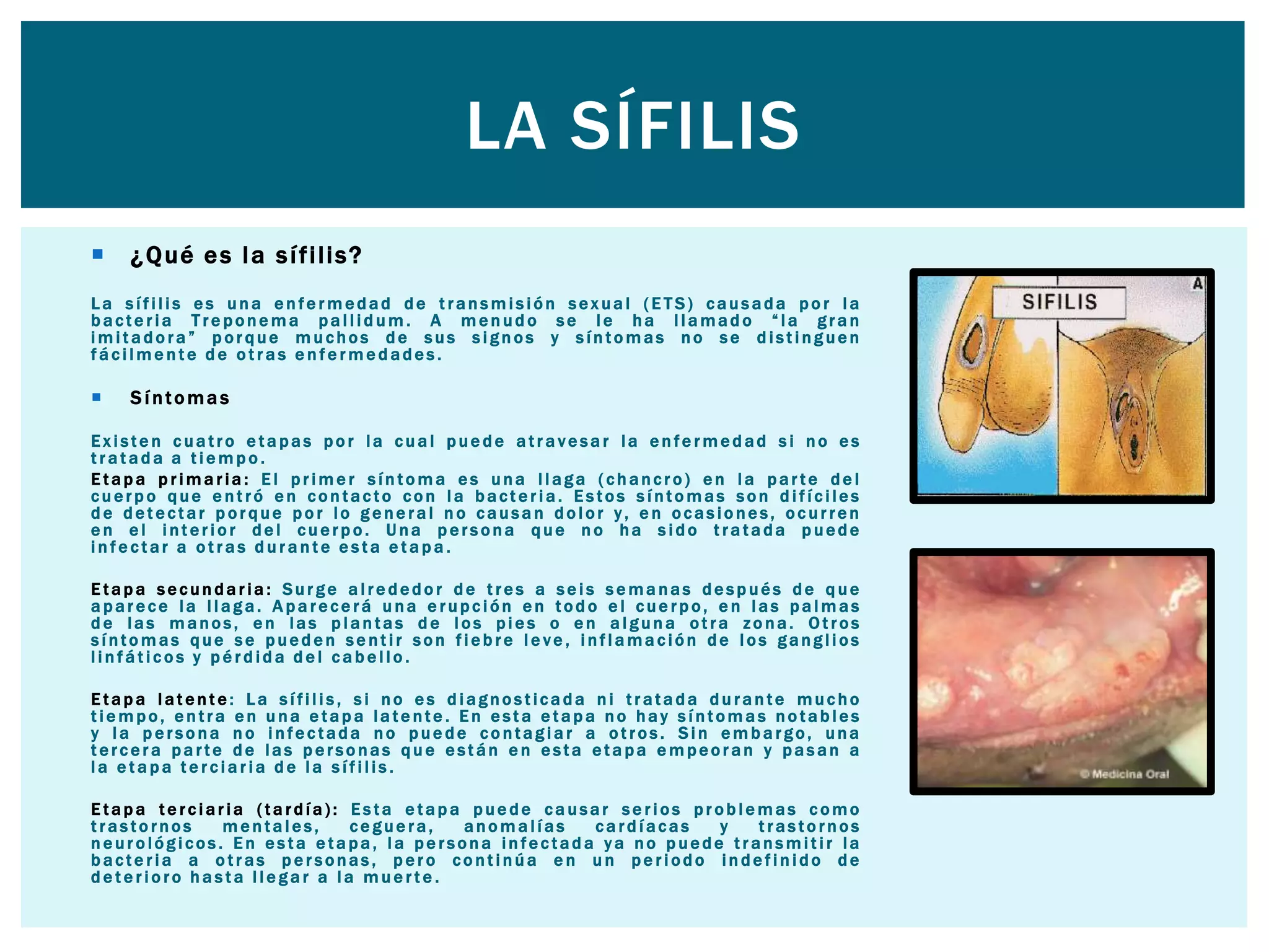 Enfermedades de transmisión sexual (ets) | PPTX
