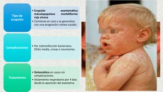 Enfermedades eruptivas de la infancia | PPTX