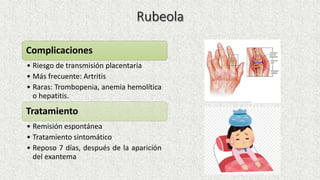 Enfermedades eruptivas de la infancia | PPTX