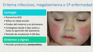 Enfermedades eruptivas de la infancia | PPTX