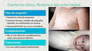 Enfermedades eruptivas de la infancia | PPTX