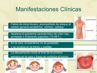 Enfermedades Eruptivas de la infancia | PPT