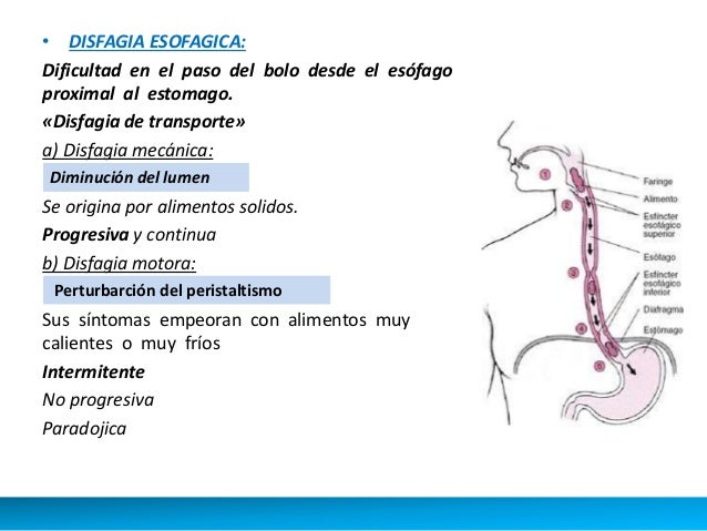 Causas De Enfermedades Del Esofago