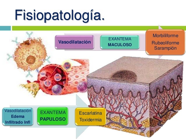 Enfermedades Exantematicas