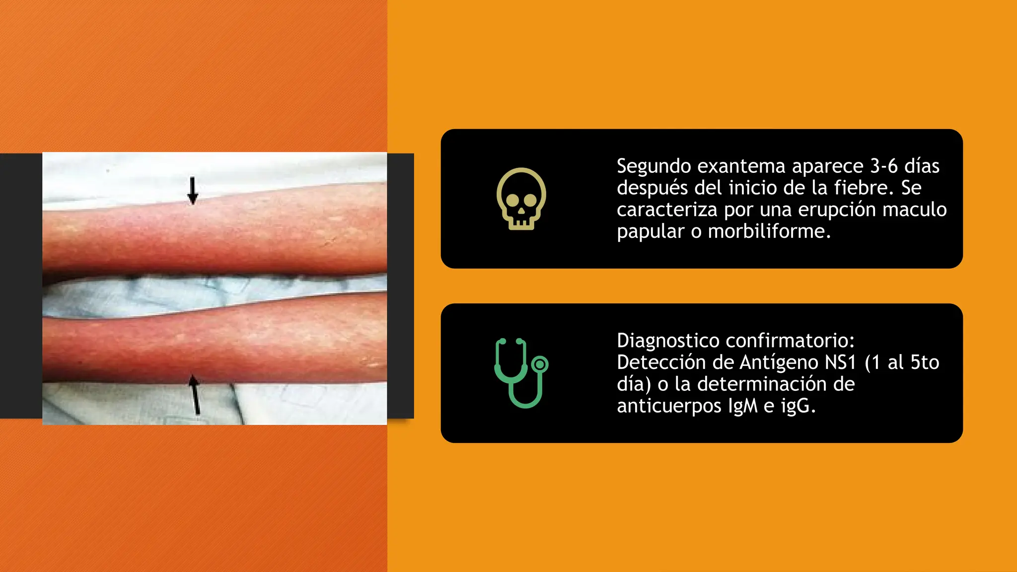 ENFERMEDADES EXANTEMICAS SEGUN LA GPC PTTX | PPTX