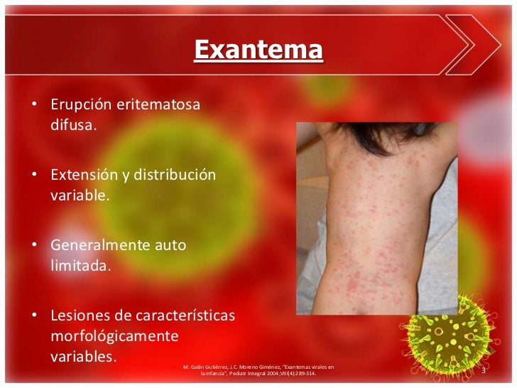 Enfermedades exantemáticas