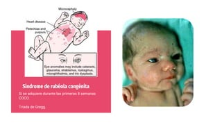 Enfermedades exantemáticas.pptx