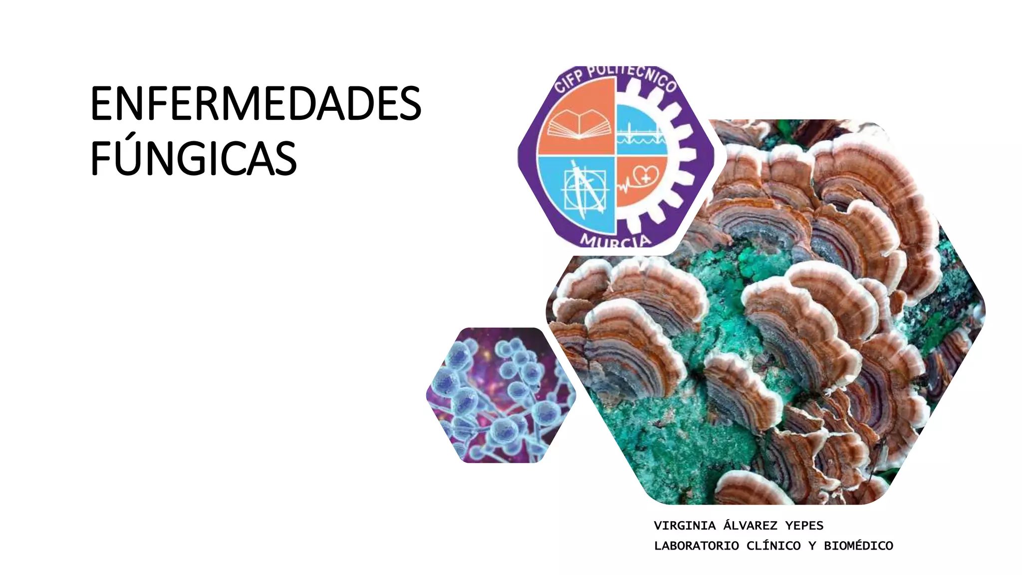 ENFERMEDADES FÚNGICAS.pptx