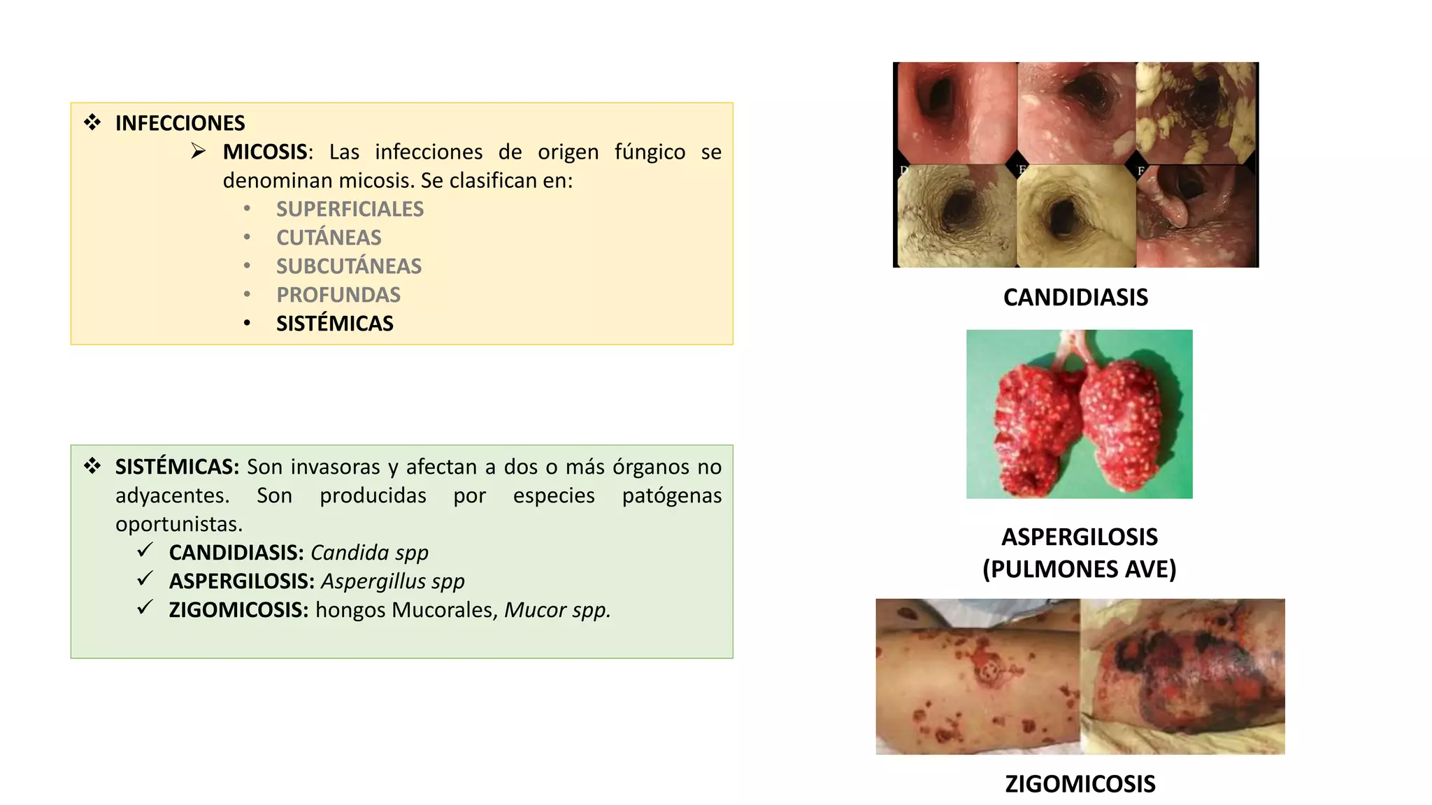 ENFERMEDADES FÚNGICAS.pptx