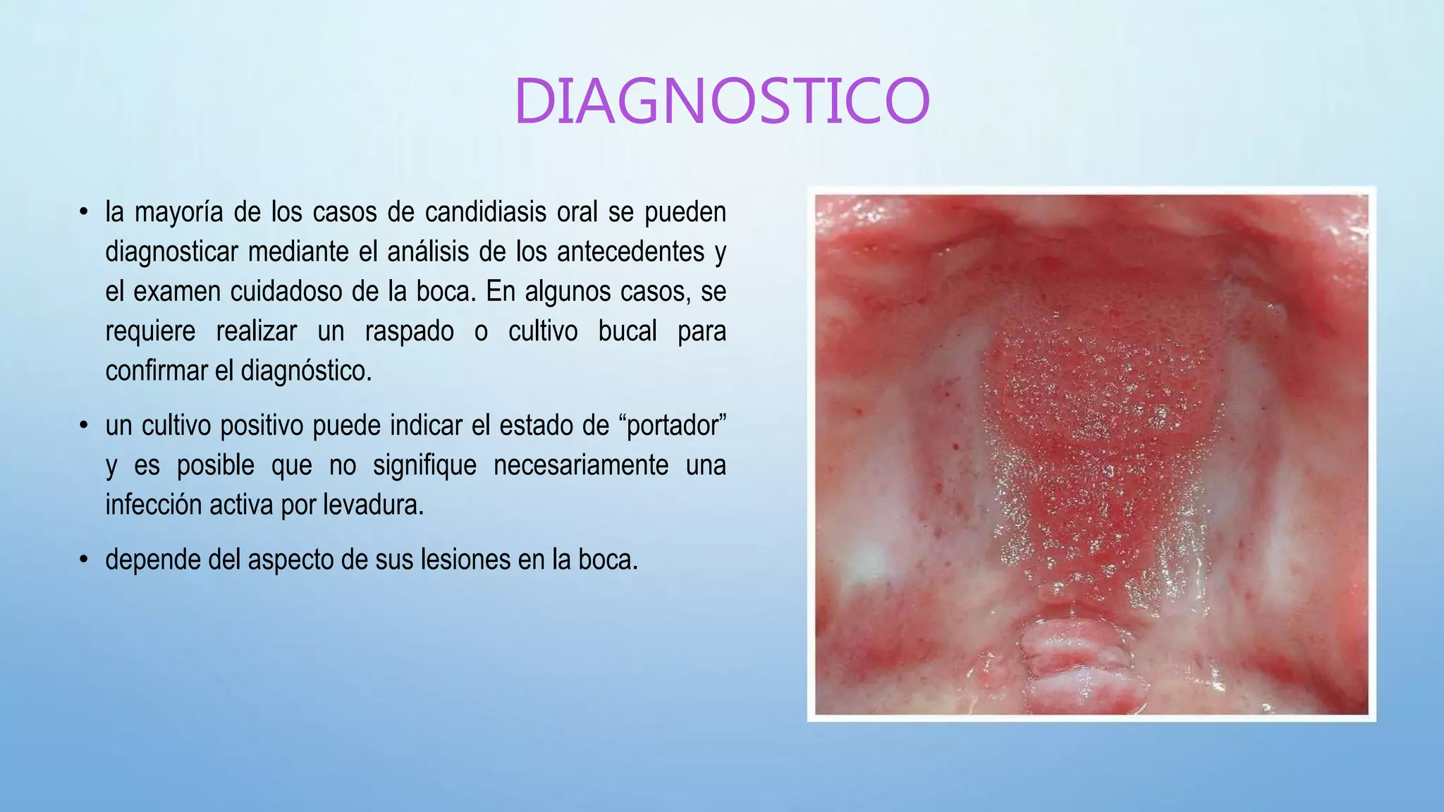 ENFERMEDADES INFECCIOSAS MICOTICAS CAVIDAD ORAL.pptx