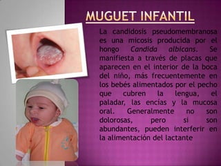 Enfermedades mas comunes de los niños con la letra m y n | PPTX