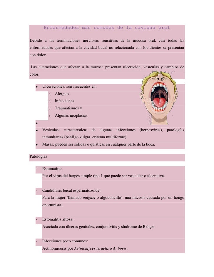 Enfermedades Más Comunes De La Cavidad Oral