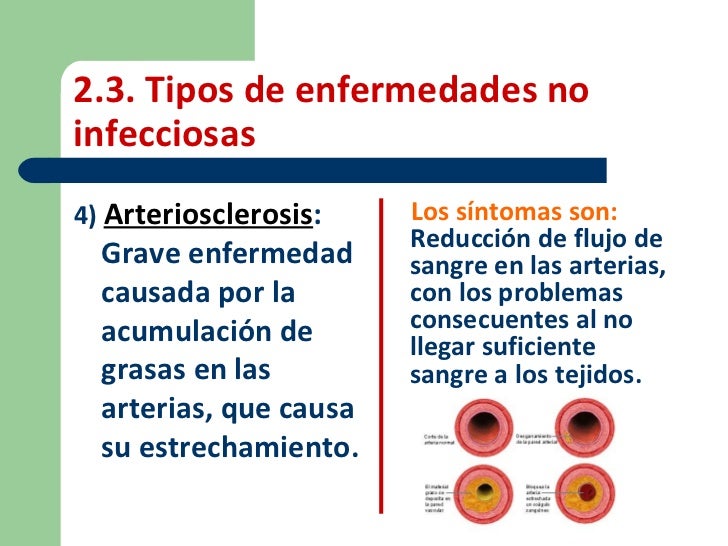 Enfermedades No Infecciosas Lista - Dinami Enfermedades No Infecciosas Lista - Dinami