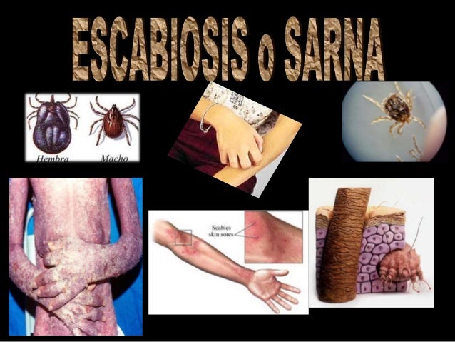 Enfermedades parasitarias de la piel 118