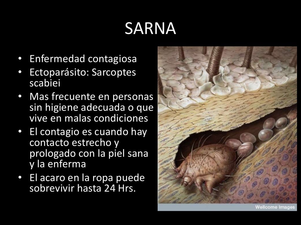 Enfermedades parasitarias de la piel 118