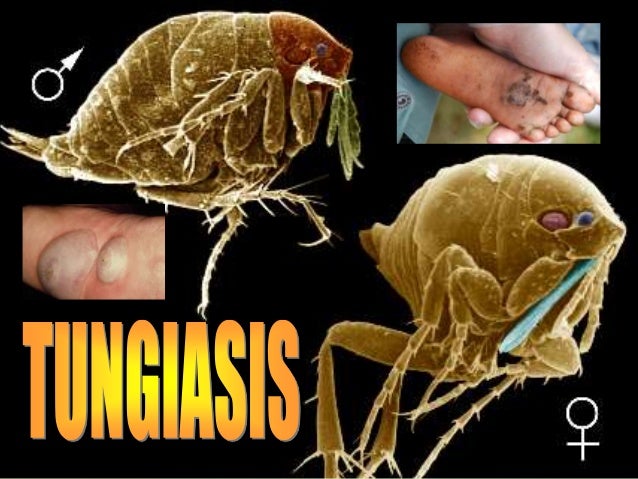 Enfermedades parasitarias de la piel 118