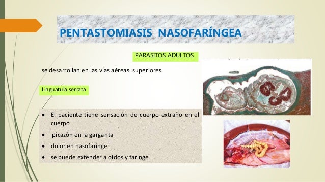 Enfermedades por artropodos