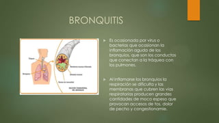 Enfermedades respiratorias | PPTX