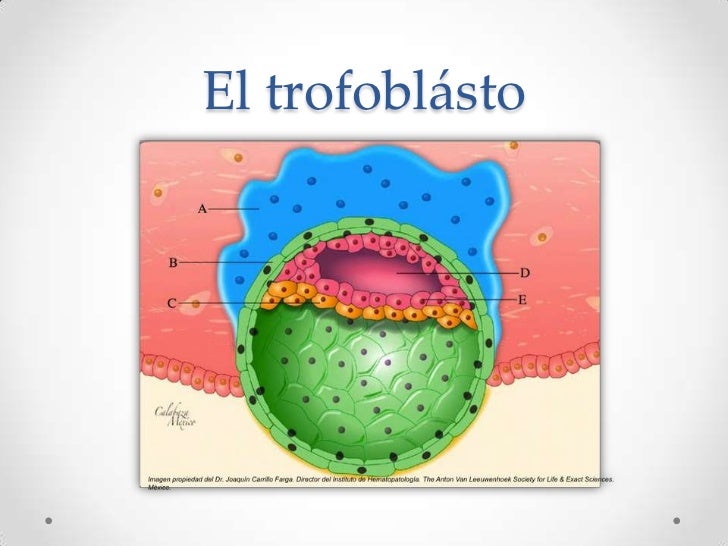 Enfermedad trofoblastica gestacional