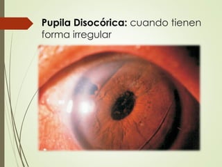 enfermedades visuales.pdf