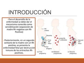 Enfermedad hemolítica fetal por incompatibilidad rh | PPTX