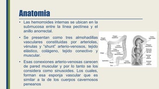 Enfermedad Hemorroidal | PPTX