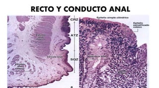 Enfermedad inflamatoria intestinal | PPTX