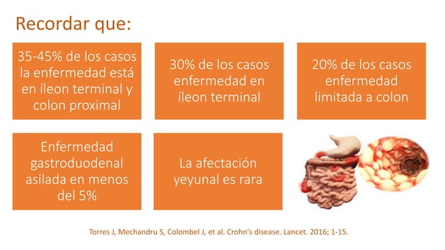 Enfermedad Inflamatoria Intestinal: CUCI y Crohn | PPTX