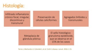 Enfermedad Inflamatoria Intestinal: CUCI y Crohn | PPTX