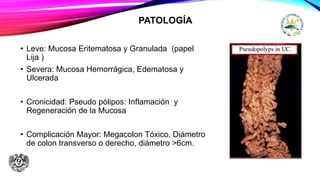 ENFERMEDAD INFLAMATORIA INTESTINAL Y MEGACOLON.pptx