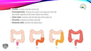 ENFERMEDAD INFLAMATORIA INTESTINAL Y MEGACOLON.pptx