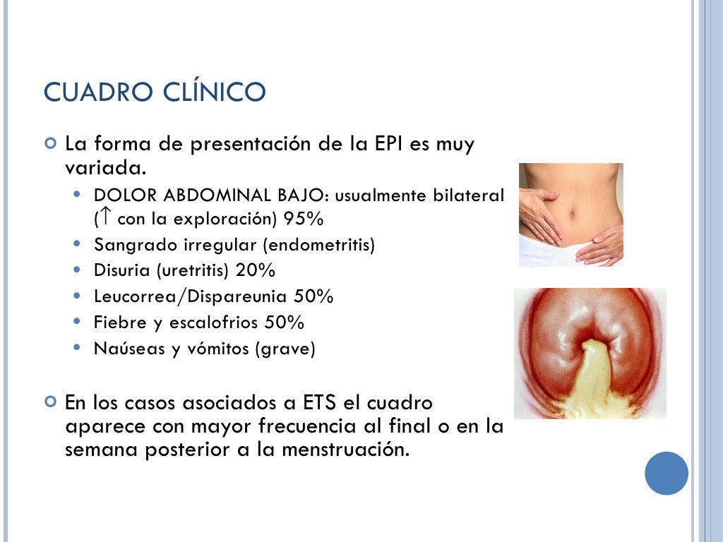 Cid Doença Inflamatória Pélvica - RETOEDU Cid Doença Inflamatória Pélvica - RETOEDU