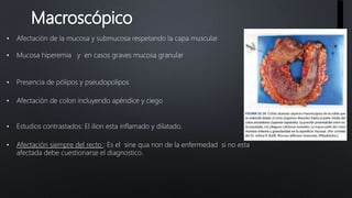 Enfermedad intestinal inflamatoria | PPTX