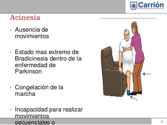 Enfermedad parkinson