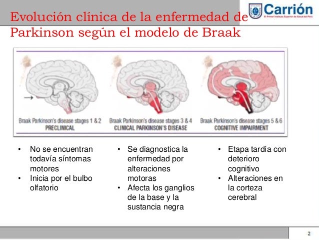 Enfermedad parkinson