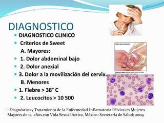 Enfermedad pelvica inflamatoria | PPTX
