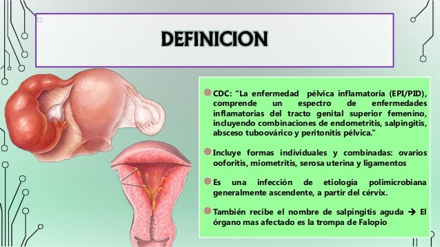 Enfermedad Pélvica Inflamatoria Pdf – UNTZ