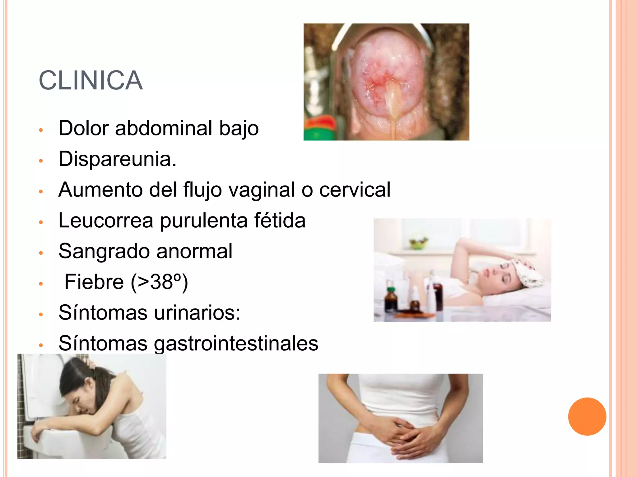 ENFERMEDAD PELVICA INFLAMATORIA.pptx