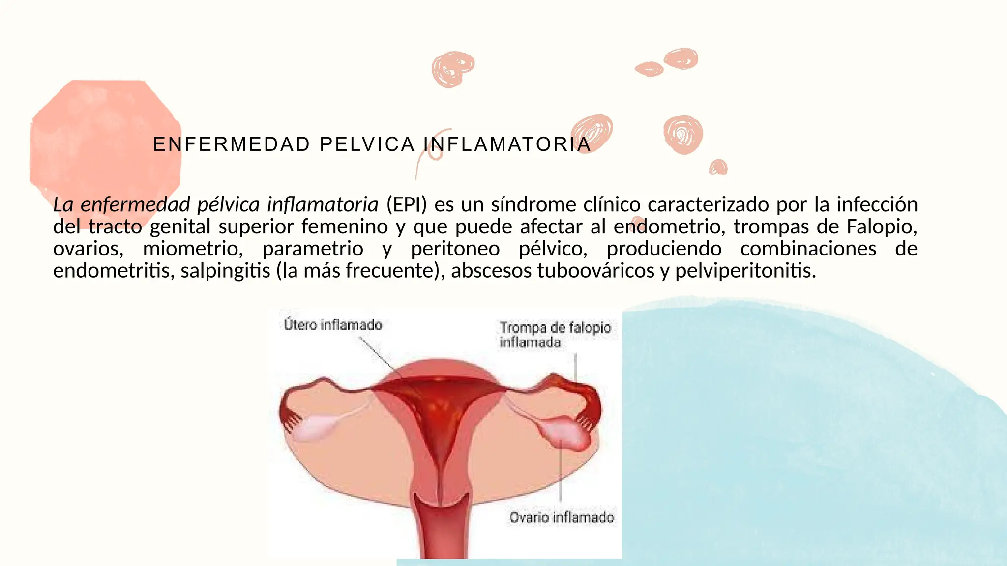 enfermedad pelvica inflamatoria, resumido y comprensible | PPTX