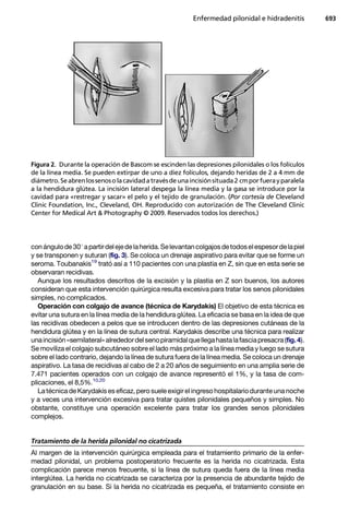 Enfermedad pilonidal e hidradenitis | PDF