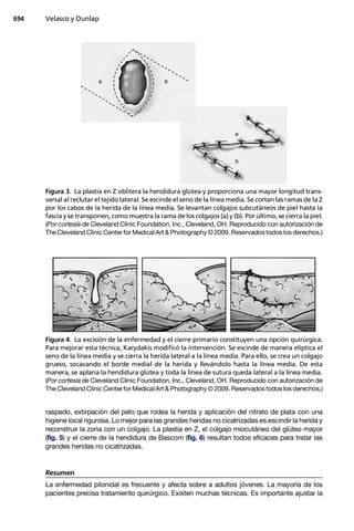 Enfermedad pilonidal e hidradenitis | PDF
