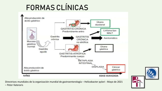 Enfermedad por Helicobacter pylori 2023.pptx