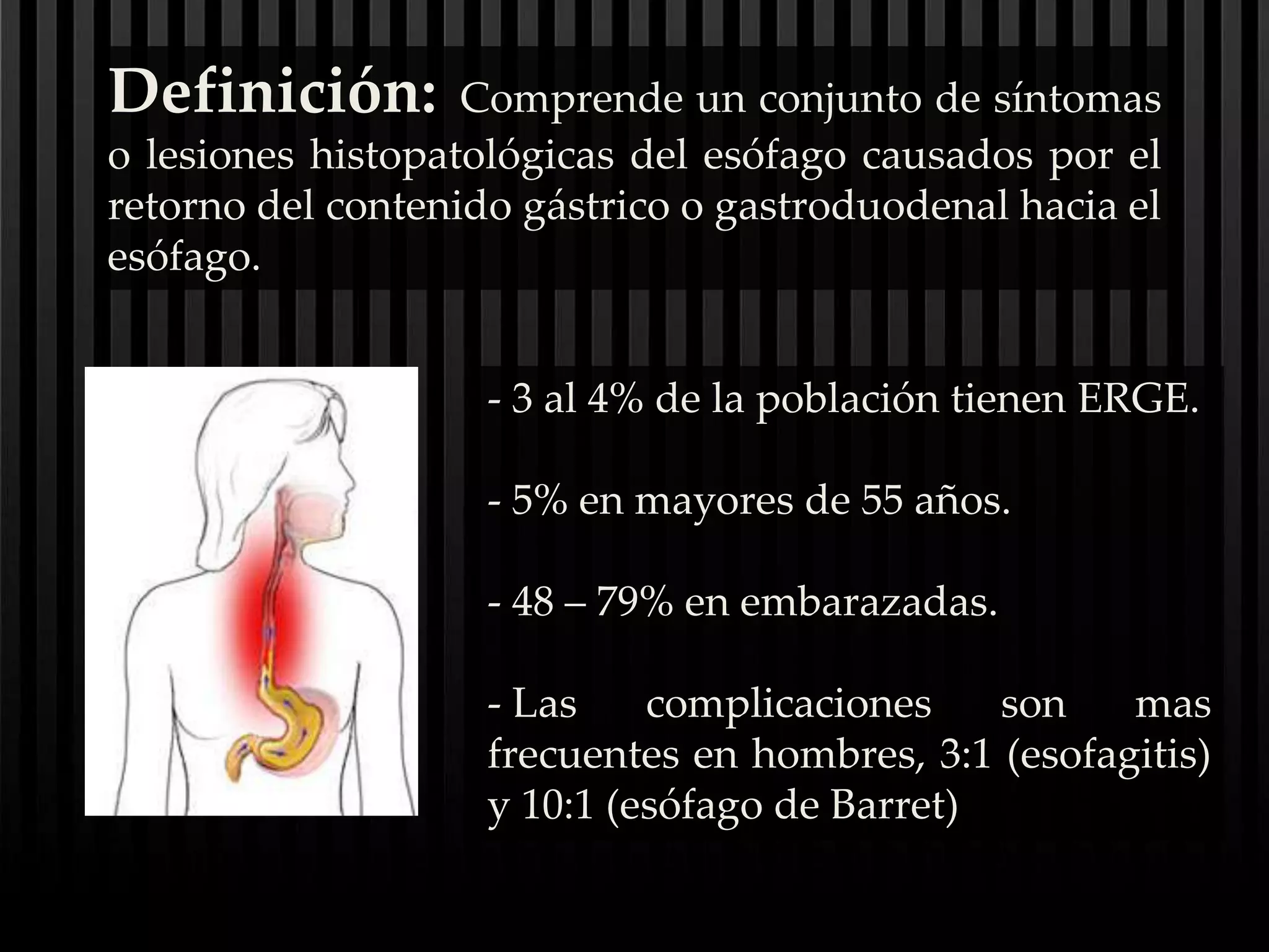 Enfermedad Por Reflujo Gastroesofagico Erge Ppt