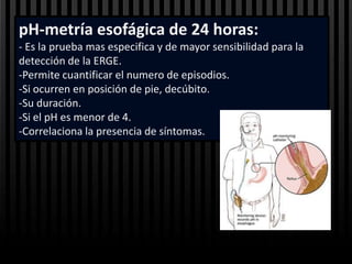 Enfermedad Por Reflujo Gastroesofagico (ERGE) | PPTX