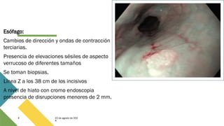 ENFERMEDAD POR REFLUJO GASTROESOFÁGICO.pptx