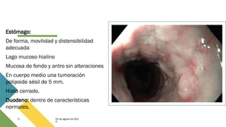 ENFERMEDAD POR REFLUJO GASTROESOFÁGICO.pptx