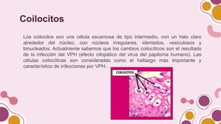 Enfermedad premaligna de cérvix Ginecologia.pptx
