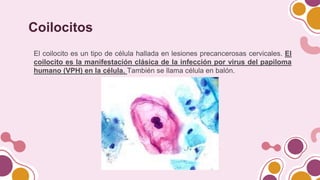 Enfermedad premaligna de cérvix Ginecologia.pptx