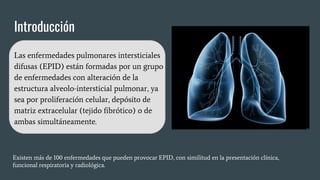 Histología De La Enfermedad Pulmonar Intersticial