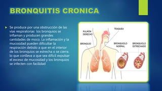 ENFERMEDAD PULMONAR OBSTRUCTIVA CRONICA.pptx